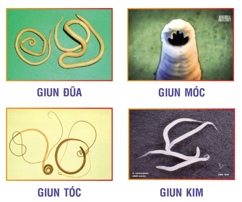 Đừng để giun sán làm tổ trong cơ thể chỉ vì tiếc 20.000 đồng